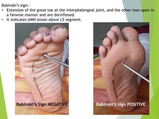 Part 5 examination of reflex | PPTX