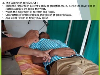 Part 5 examination of reflex | PPTX