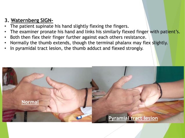 Part 5 examination of reflex