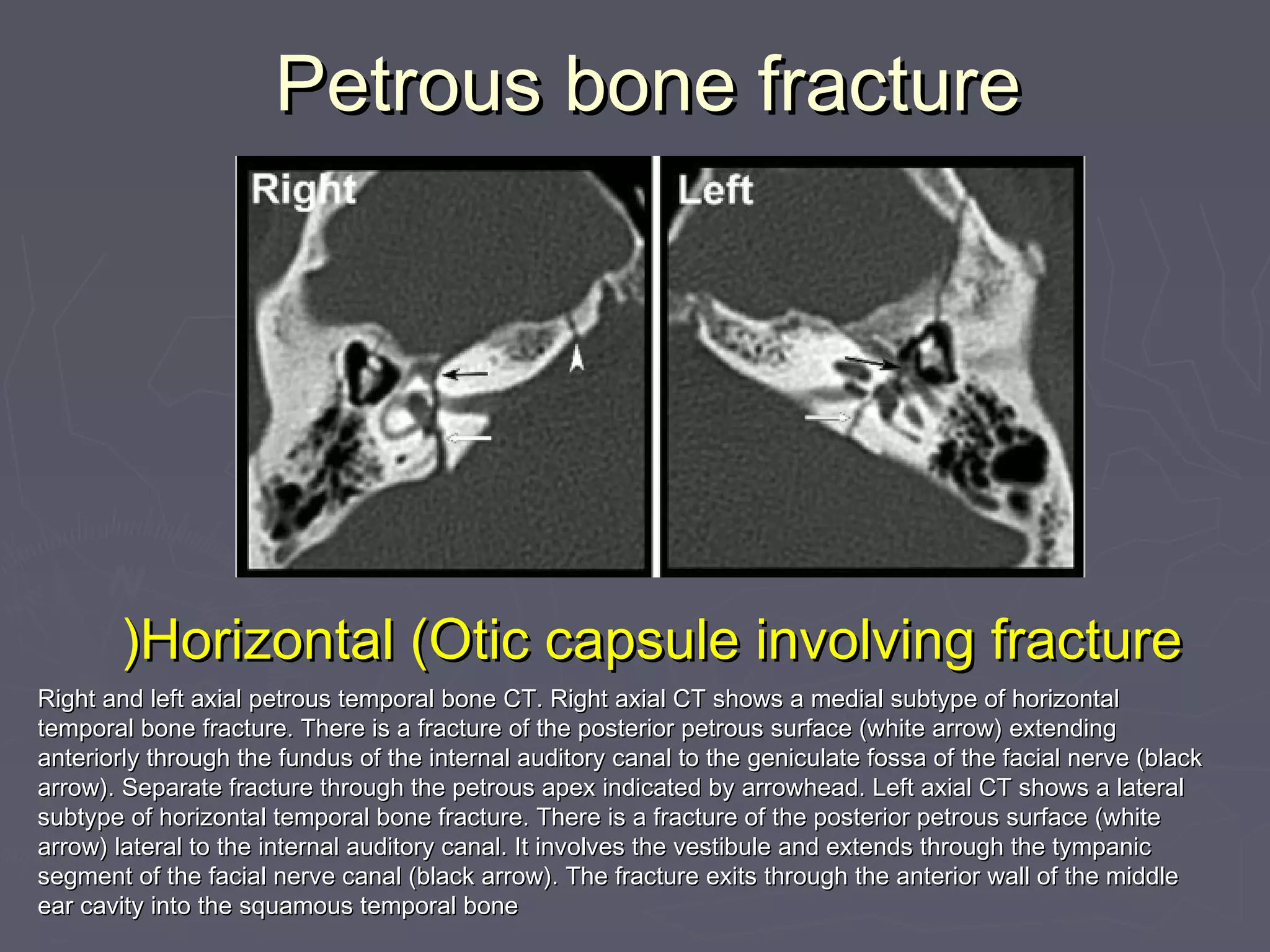 5 - Facial trauma 1 | PPT