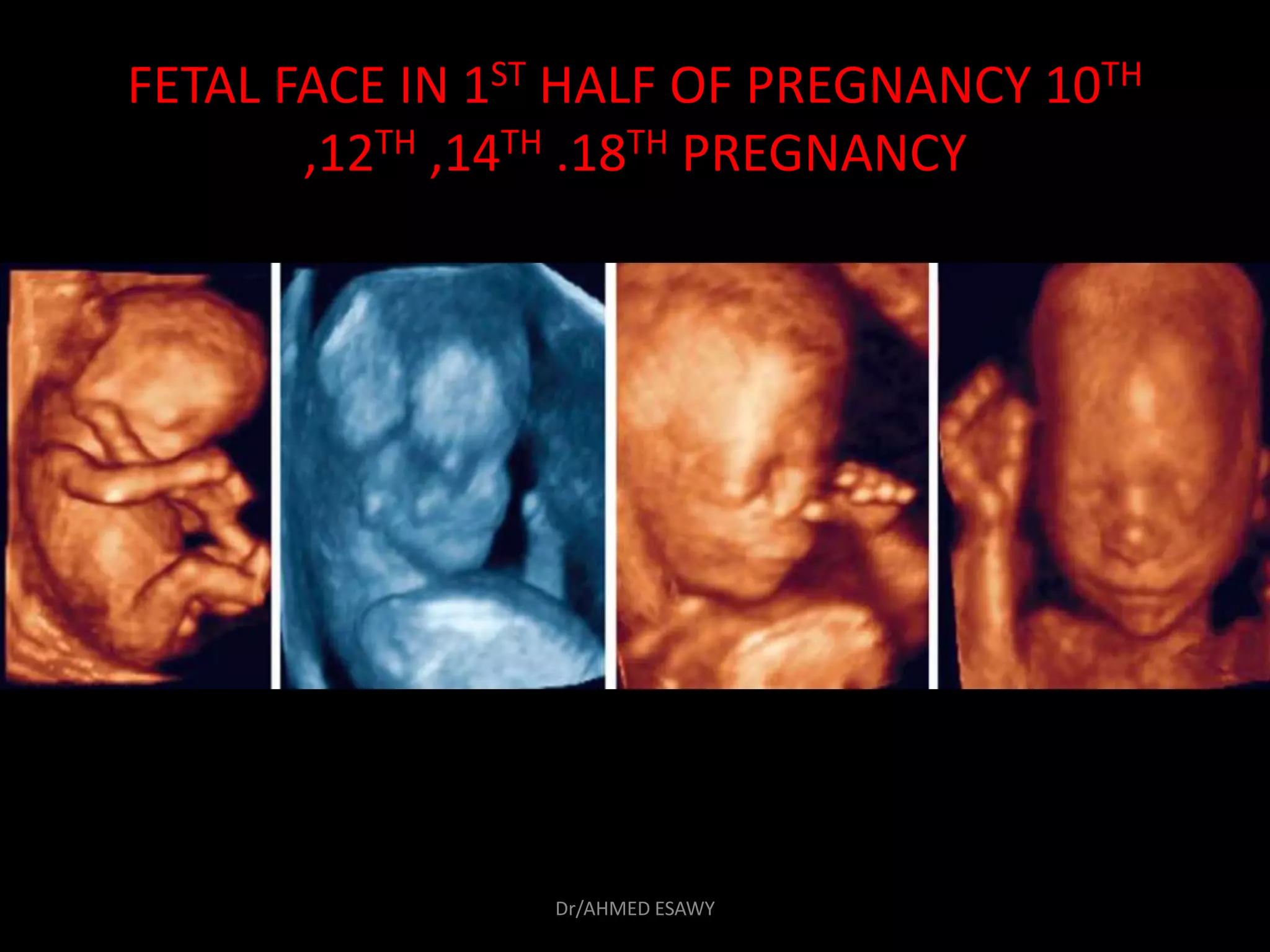 5-Fetal face ultrasound Dr Ahmed Esawy | PDF