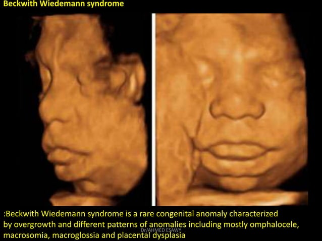 5-Fetal face ultrasound Dr Ahmed Esawy | PPT