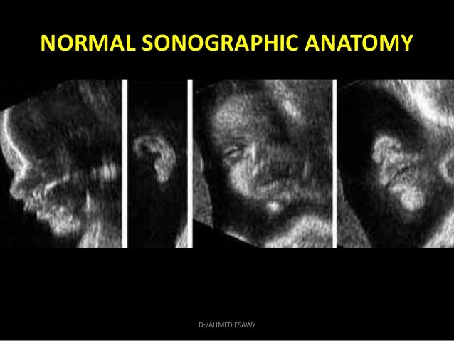5-Fetal face ultrasound Dr Ahmed Esawy