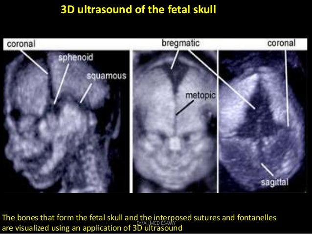 5-Fetal face ultrasound Dr Ahmed Esawy