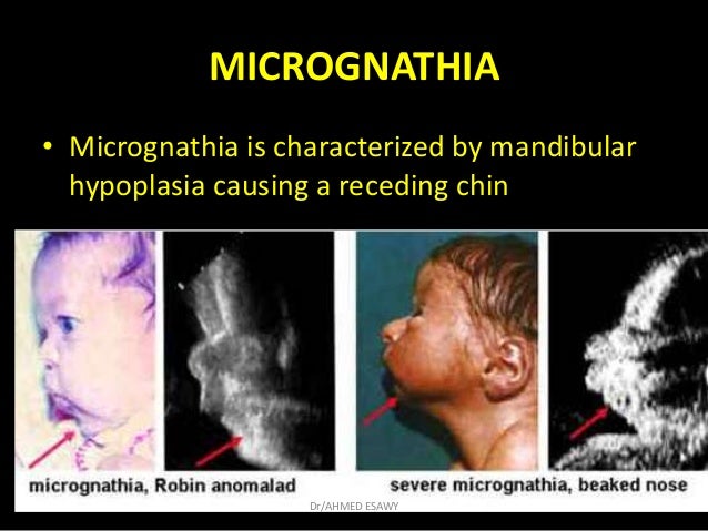 5-Fetal face ultrasound Dr Ahmed Esawy