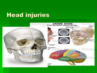 5 - Head injuries for nurses in emergency room | PPT | First Aid | Injuries