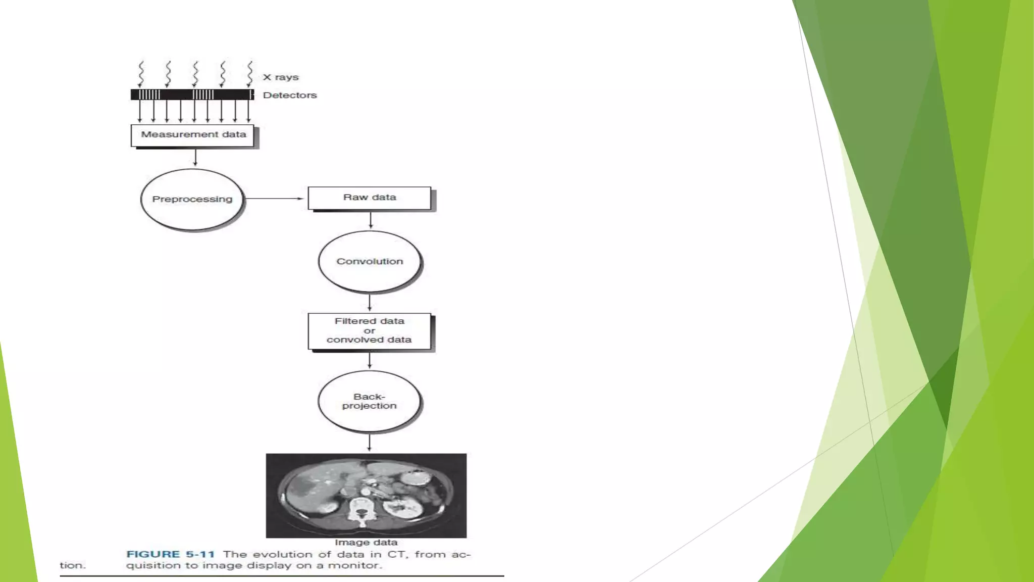 5-IMAGE RECONSTRUCTION in CT Scan-Rohit.pptx