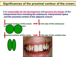 indirect factors and their significeance in protection of periodontium ...