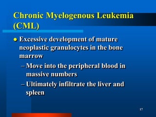 5-lecture leukemia presentation immunology | PPT