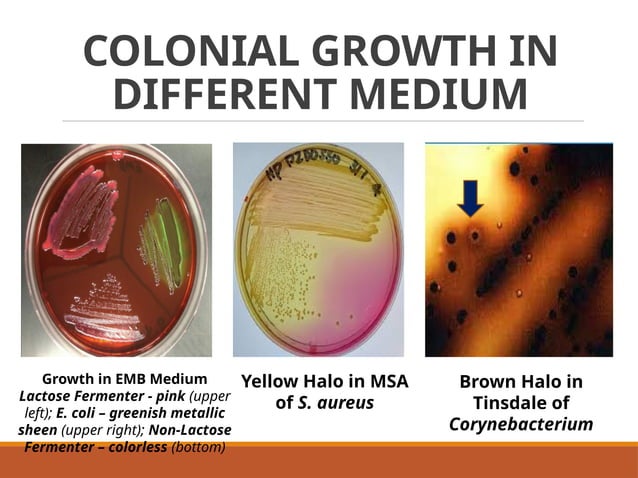 Colonial Examination of Bacterial Isolates | PPT