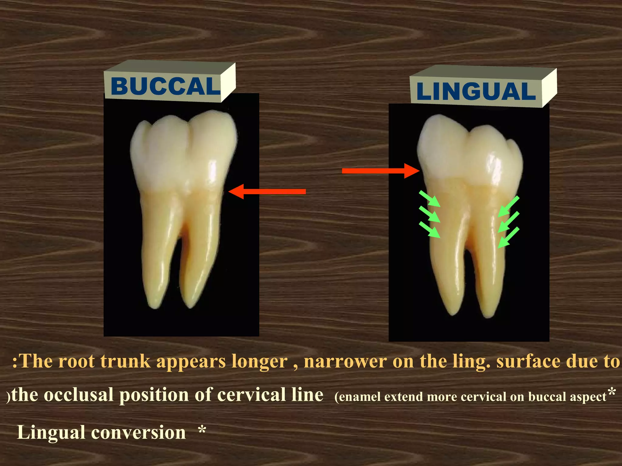 5 mandibular molars | PPT | Dental Health | Diseases and Conditions