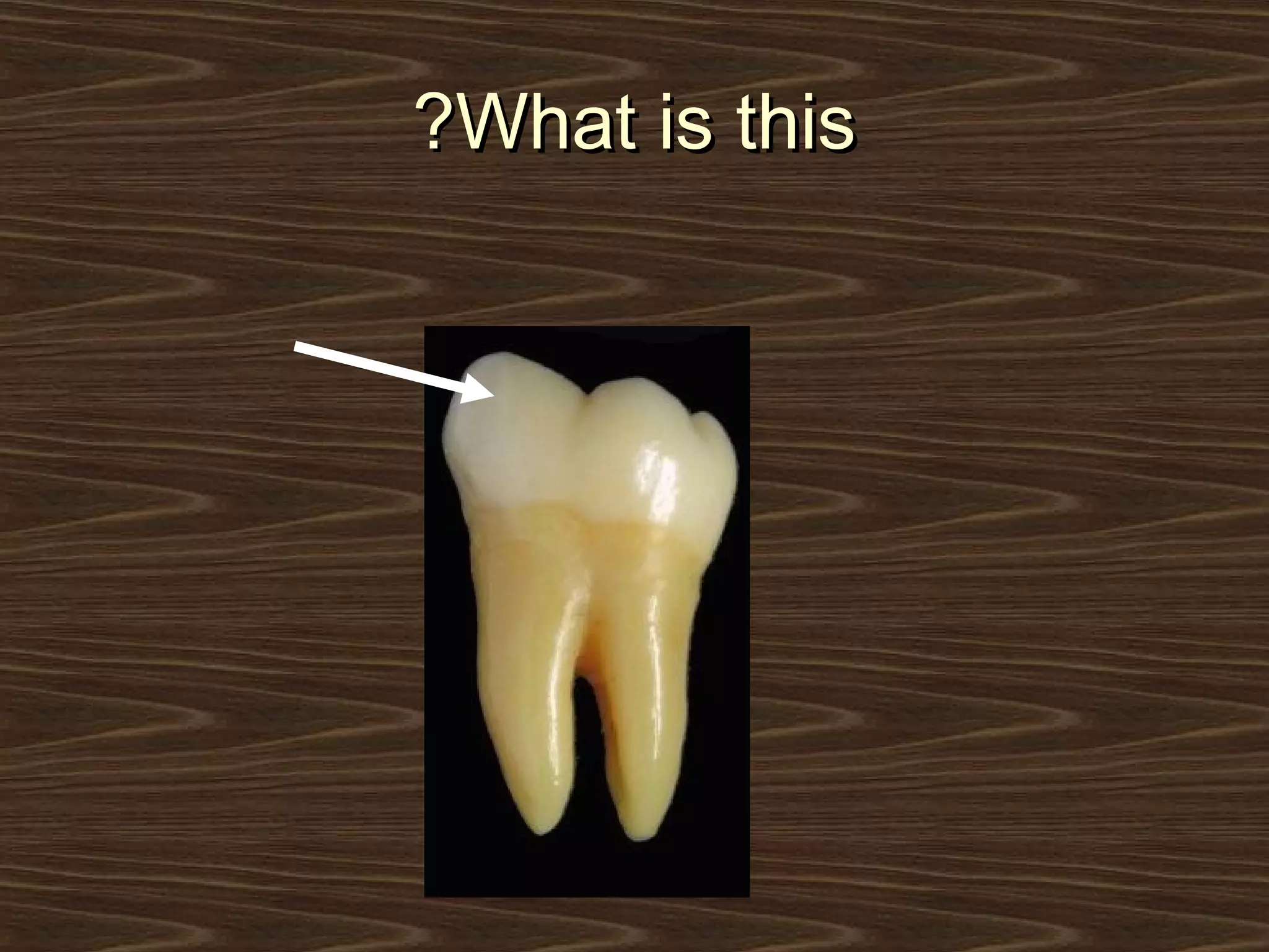 5 mandibular molars | PPT | Dental Health | Diseases and Conditions