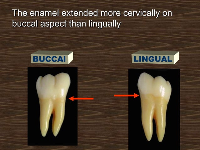 5 mandibular molars | PPT | Dental Health | Diseases and Conditions