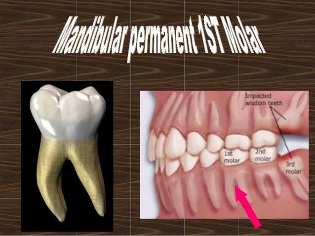5 mandibular molars