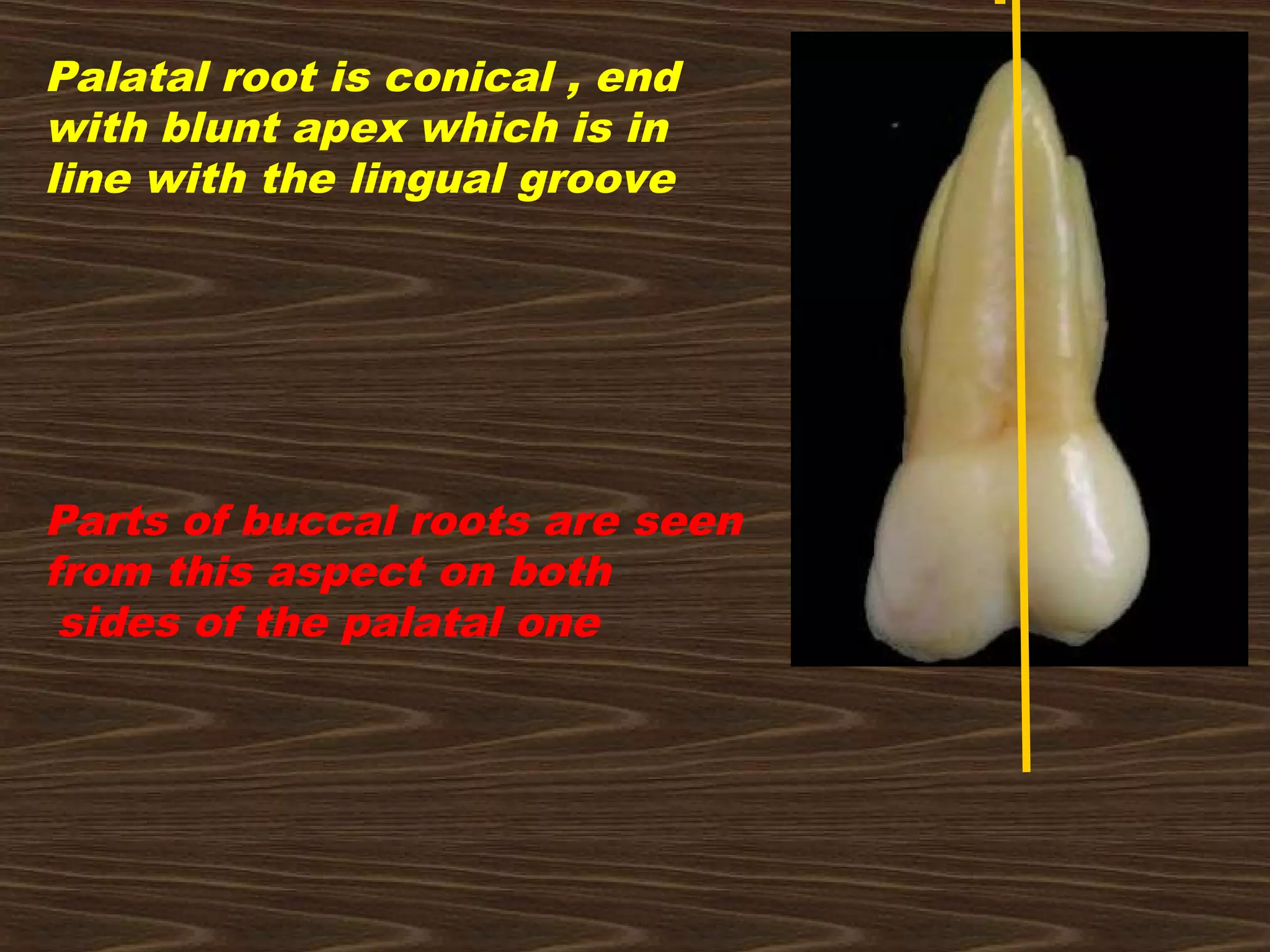maxillary first molar | PPT | Dental Health | Diseases and Conditions