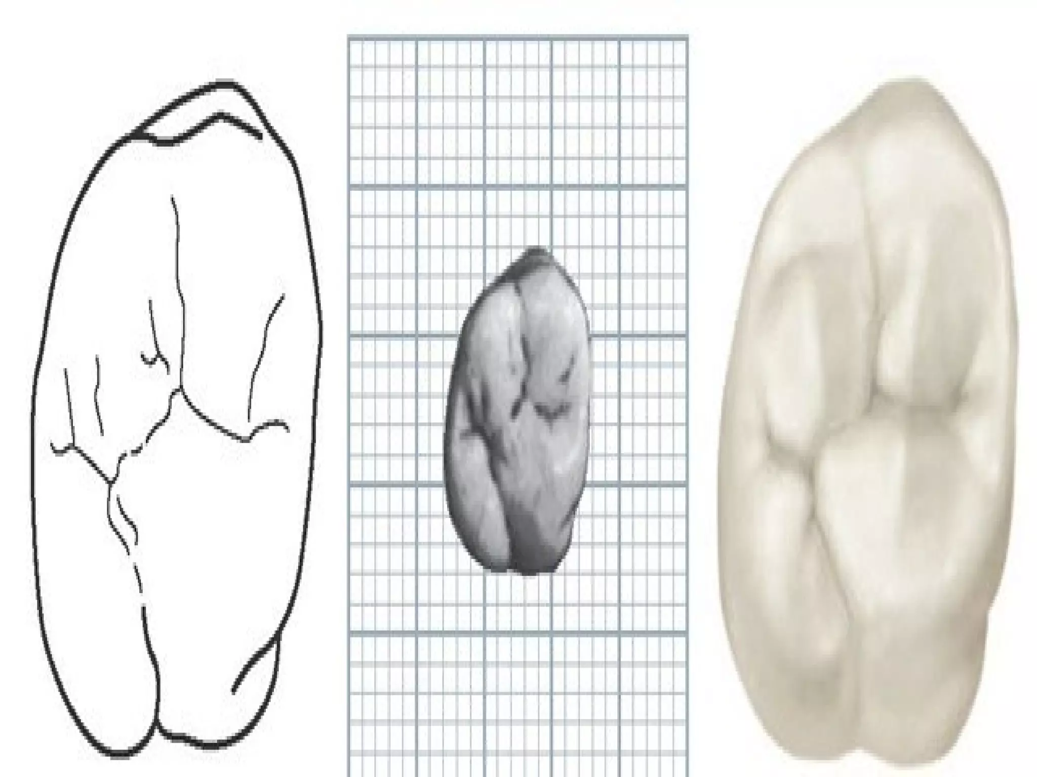 maxillary first molar | PPT
