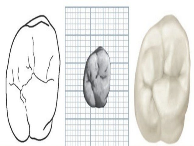 maxillary first molar