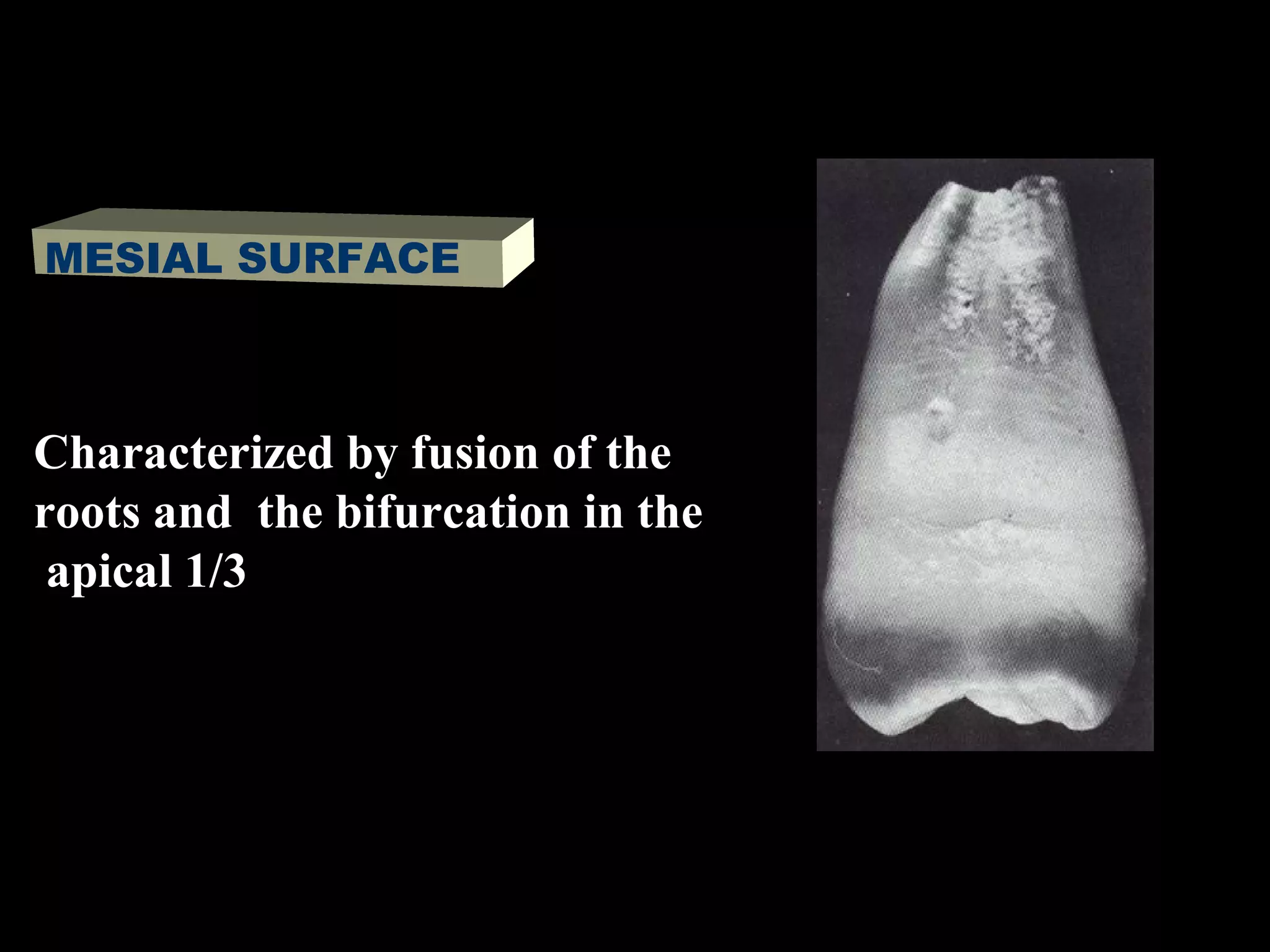 05. Maxillary Molars (CD) - Dentition | PPT