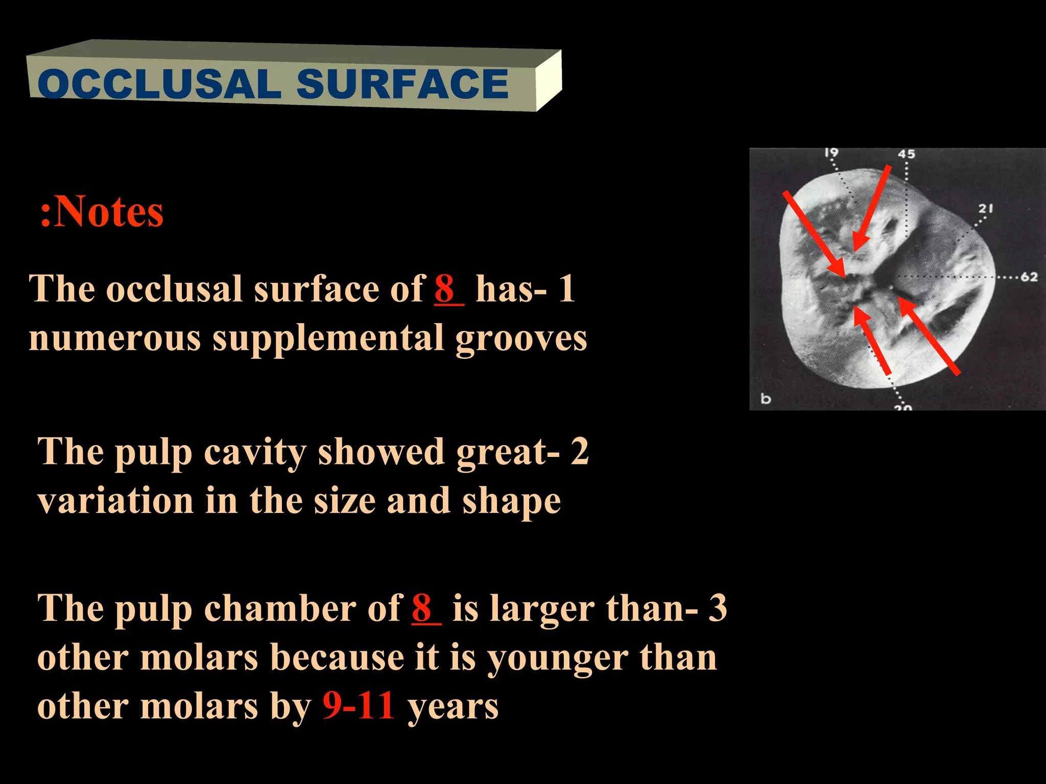 05. Maxillary Molars (CD) - Dentition | PPT
