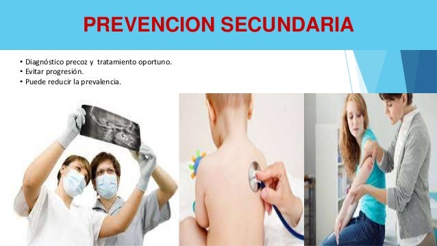5 niveles de prevension