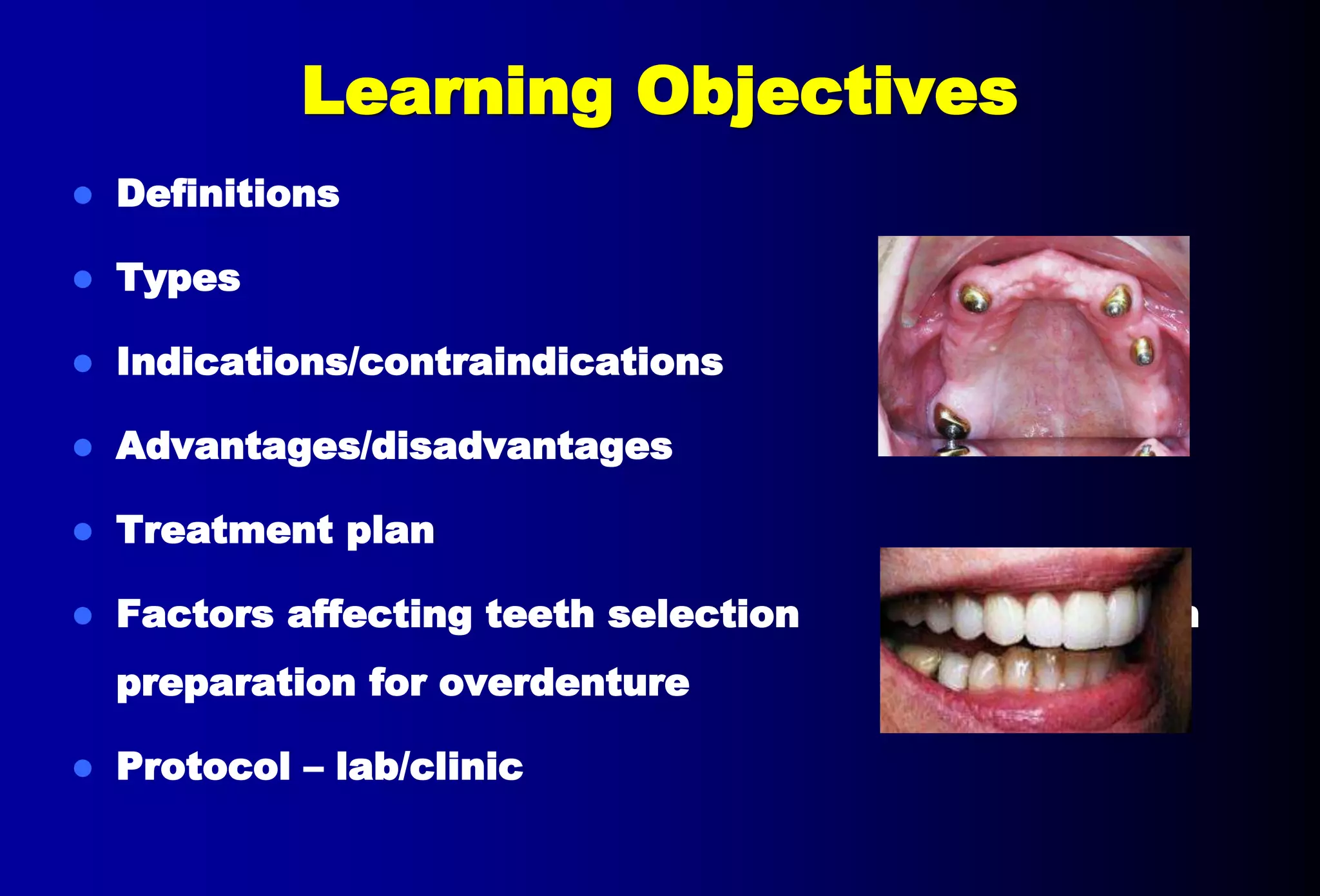 5- OVERDENTURE.pptx