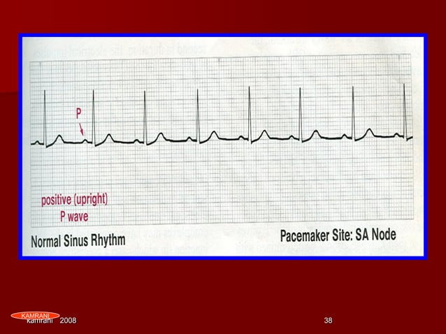 parameters of ekg interpretation-3 | PPT | Free Download