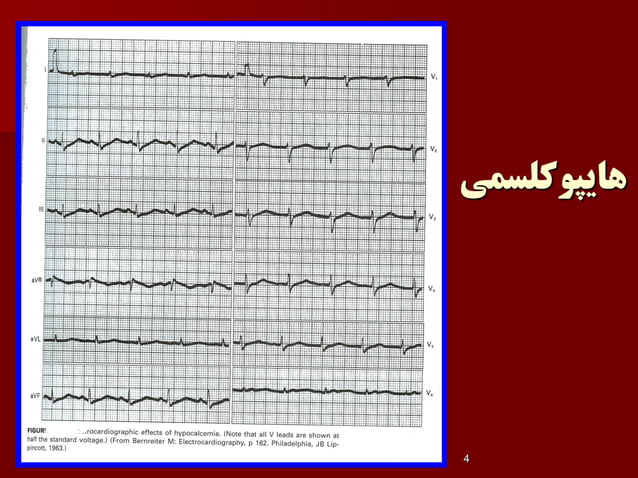 parameters of ekg interpretation-3 | PPT