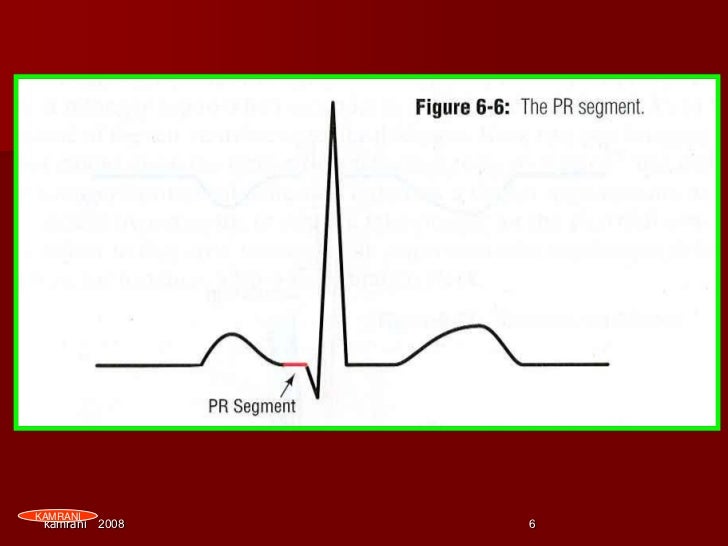 parameters of ekg interpretation-3