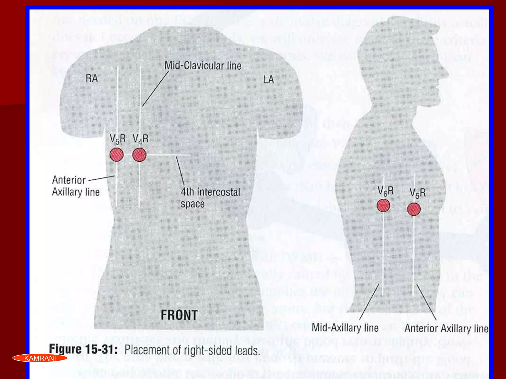 parameters of ekg interpretation-4 | PPT