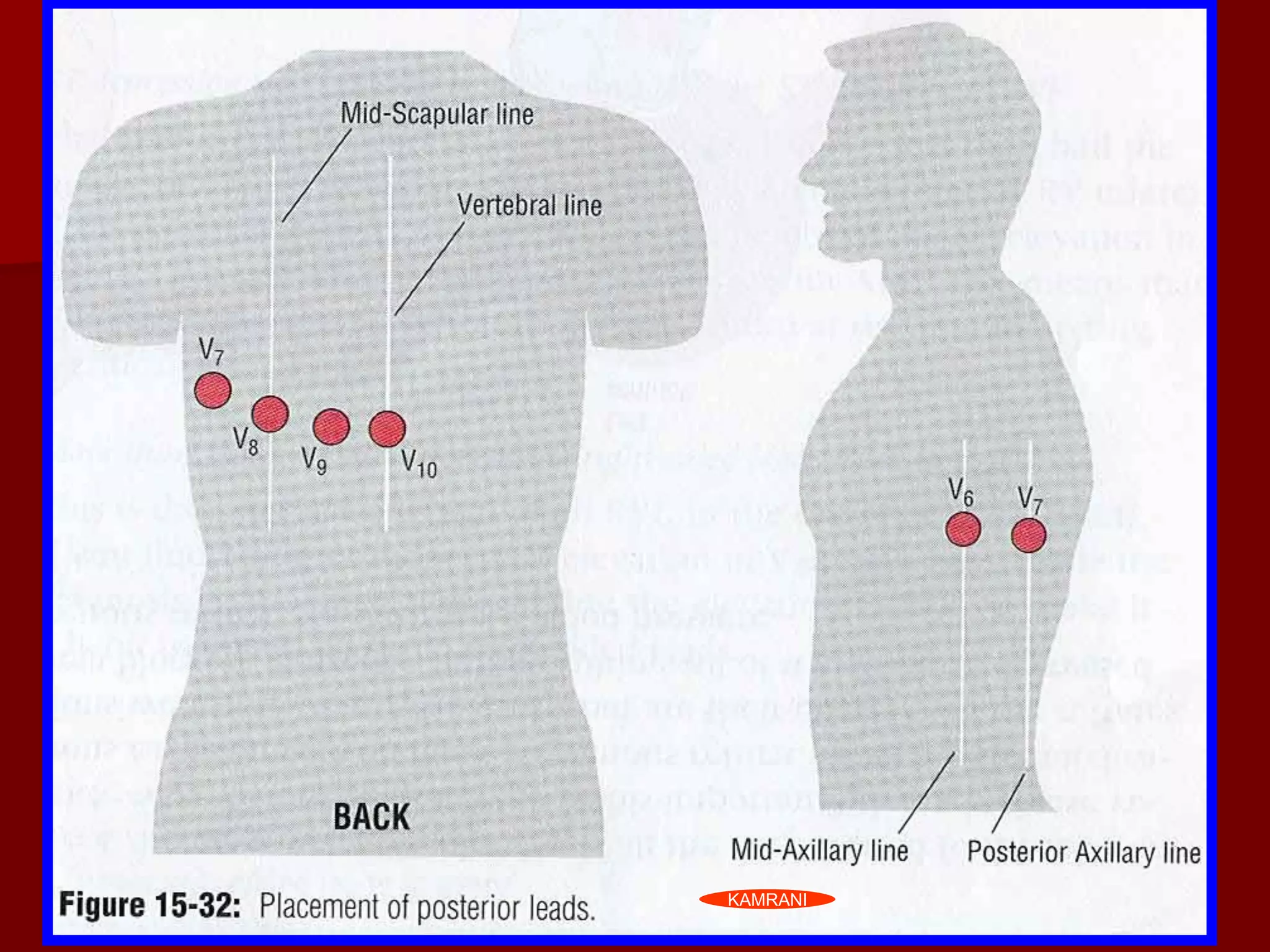 parameters of ekg interpretation-4 | PPT