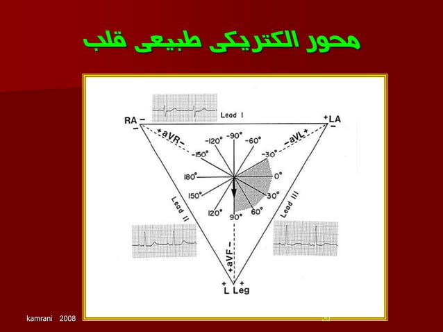 parameters of ekg interpretation-4 | PPT