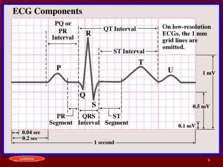 5 parameters of ekg interpretation1