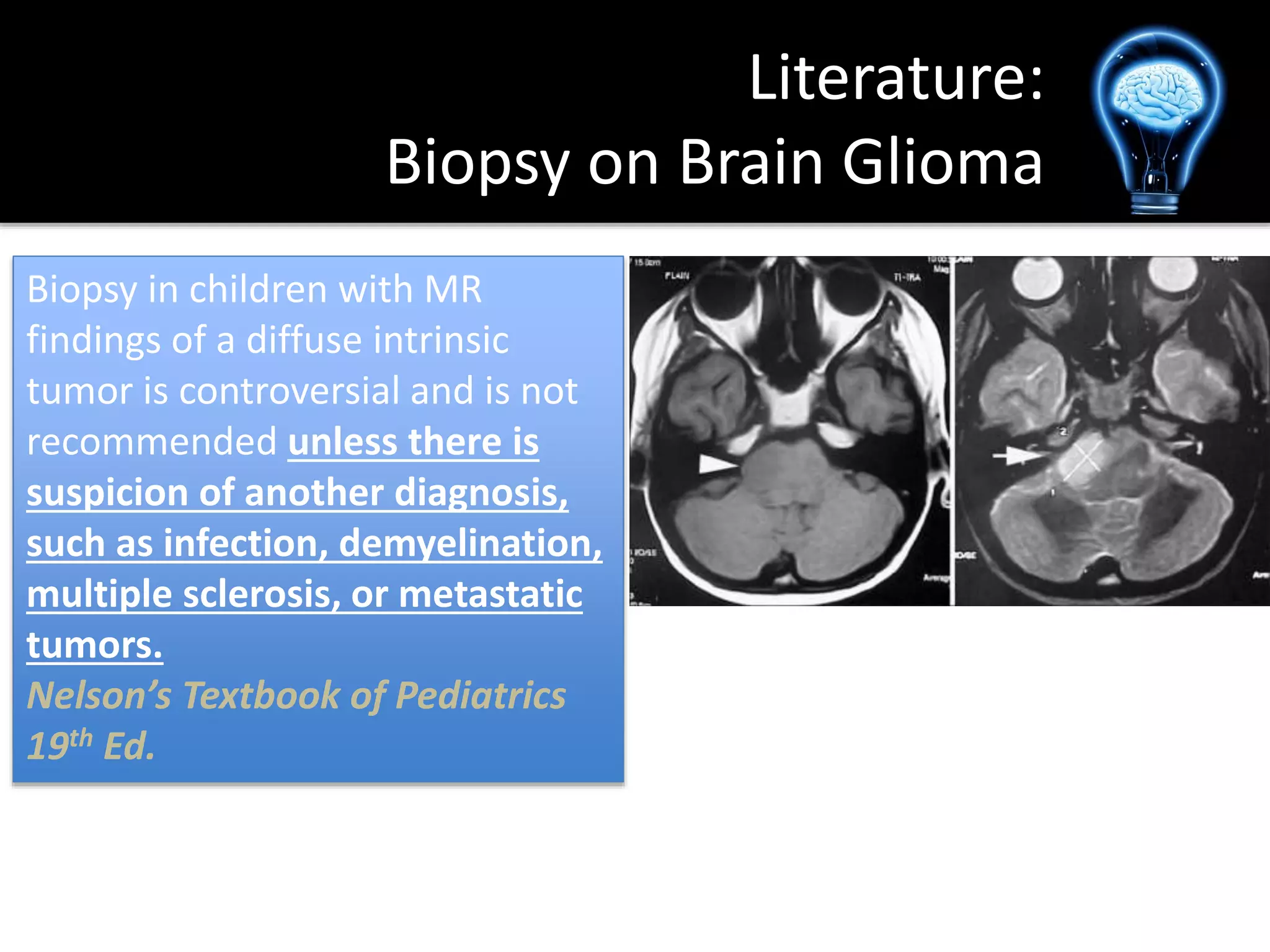 (Pediatric) Diffuse Intrinsic Pons Glioma | PPTX