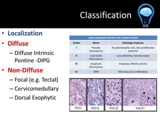 (Pediatric) Diffuse Intrinsic Pons Glioma | PPTX