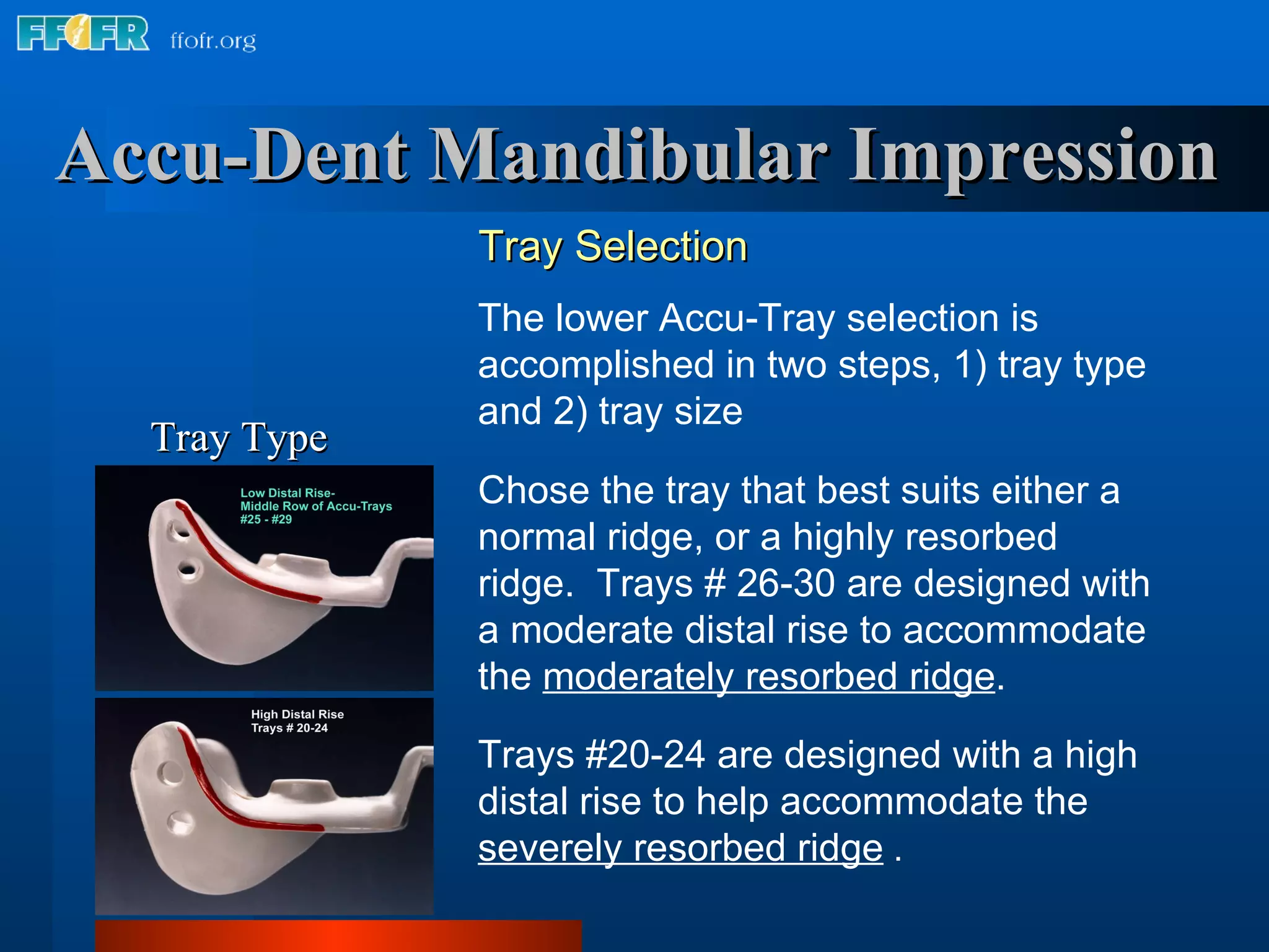 5.preliminary impressions | PPT