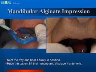 5.preliminary impressions | PPT