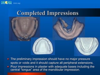 5.preliminary impressions | PPT