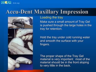 5.preliminary impressions | PPT