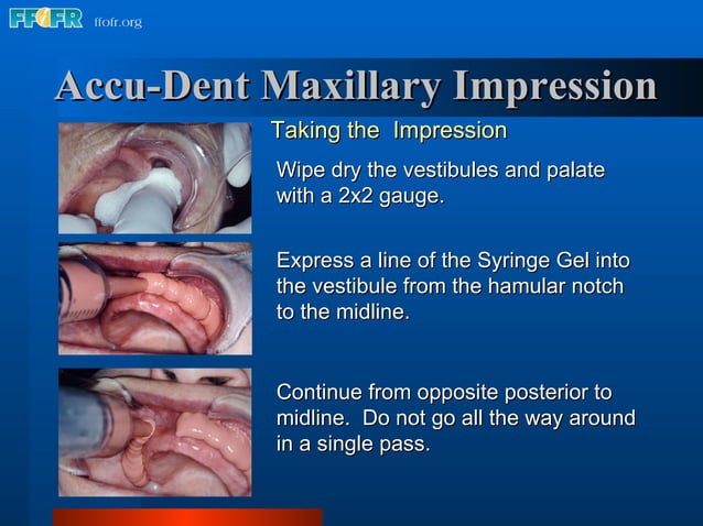 5.preliminary impressions | PPT