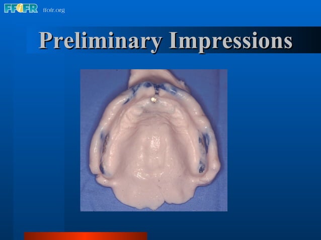 5.preliminary impressions | PPT