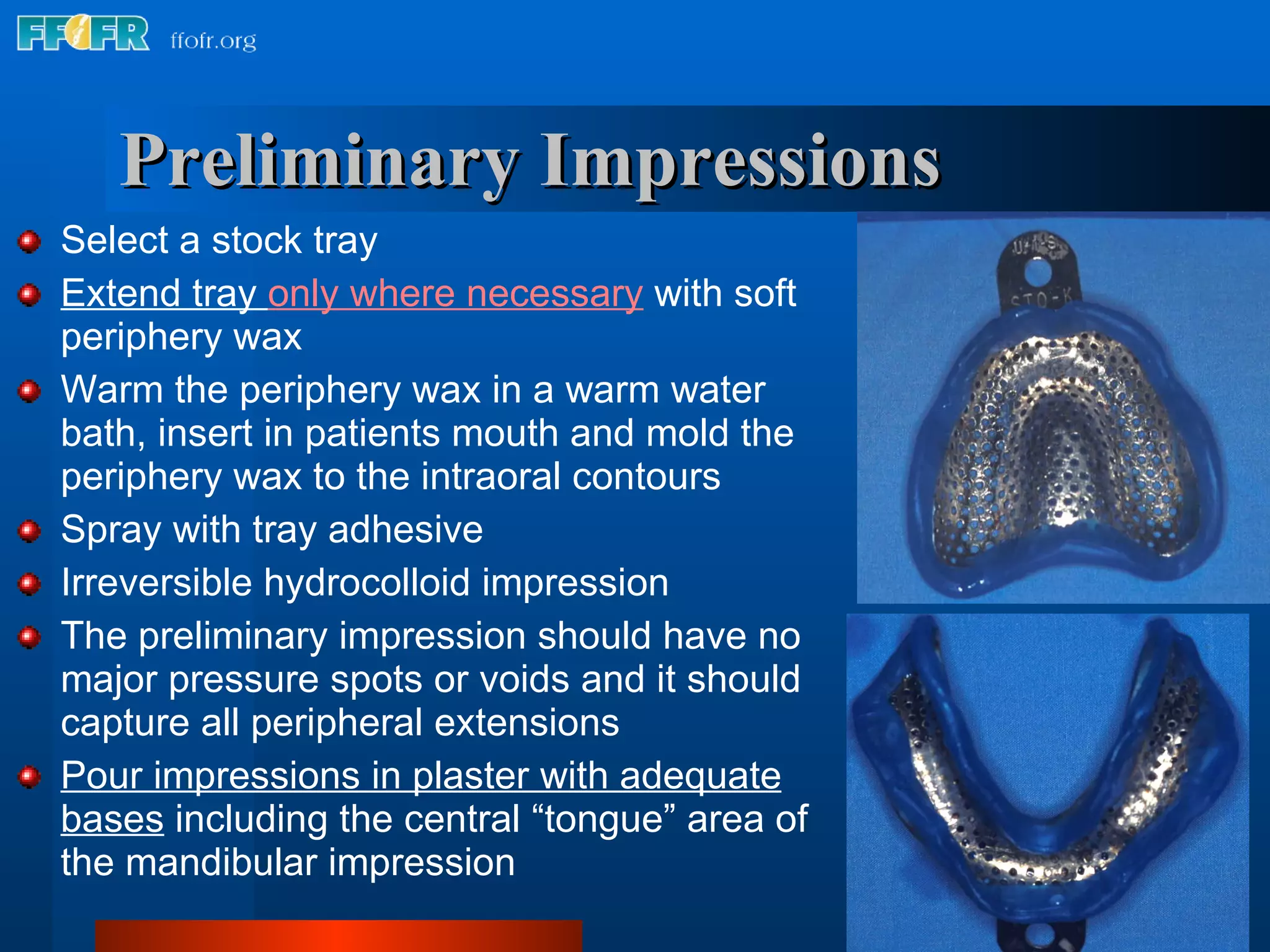 5.preliminary impressions | PPT