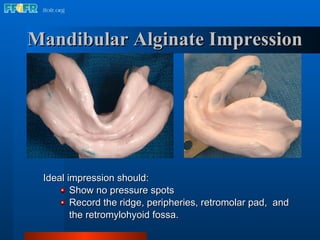 5.preliminary impressions | PPT