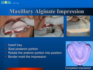 5.preliminary impressions | PPT