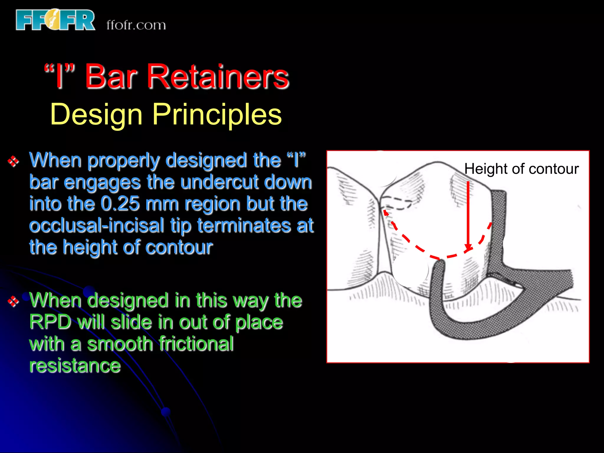 5.retainers, clasp assemblies and indirect retainers | PPT