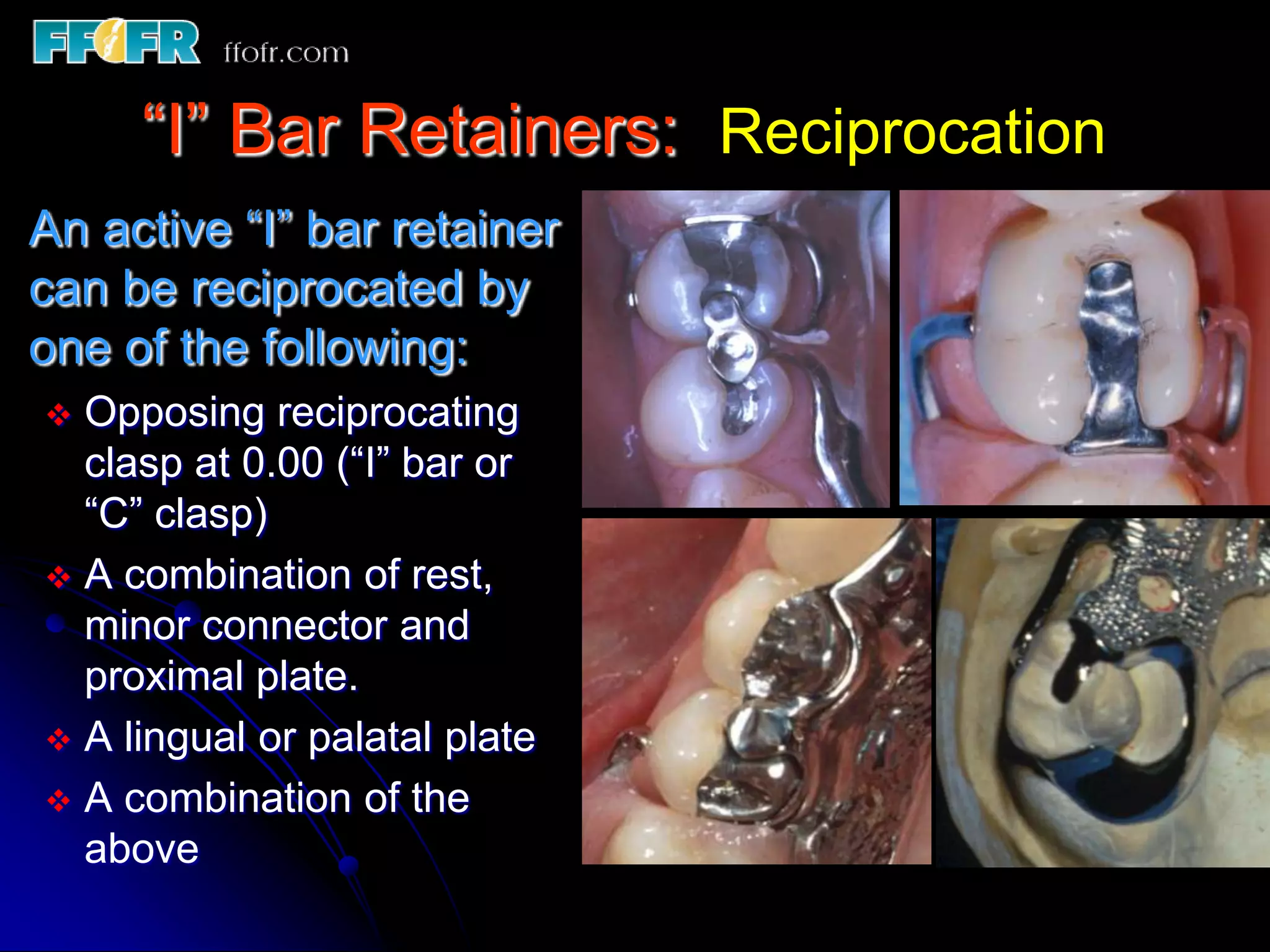 5.retainers, clasp assemblies and indirect retainers | PPT