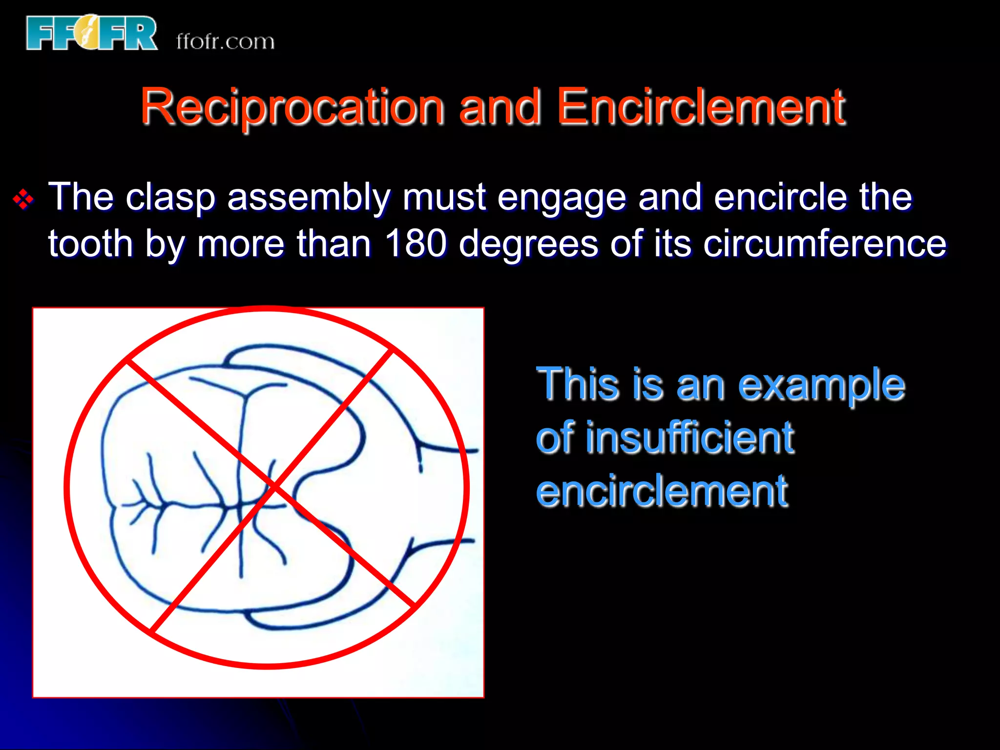 5.retainers, clasp assemblies and indirect retainers | PPT