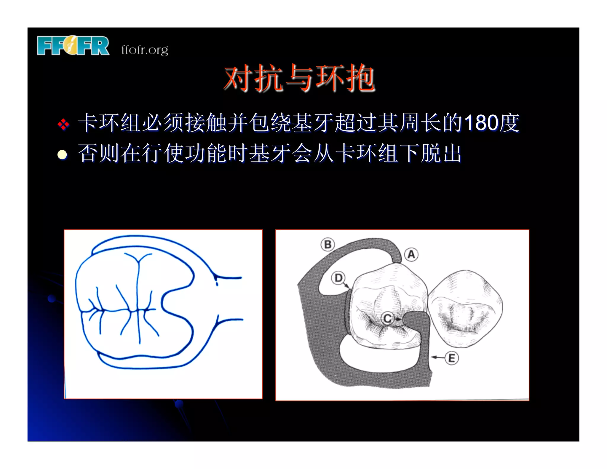 5.retainers, clasp assemblies and indirect retainers | PPT