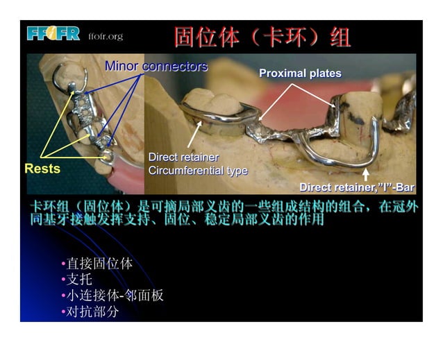5.retainers, clasp assemblies and indirect retainers | PPT