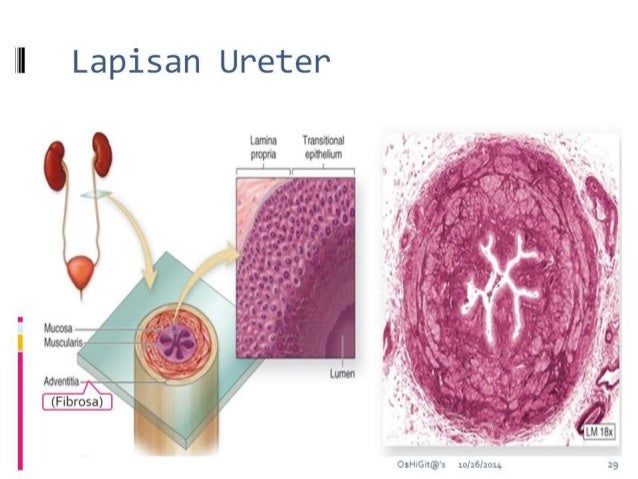 Sistem Urinaria (Sistem Perkemihan)