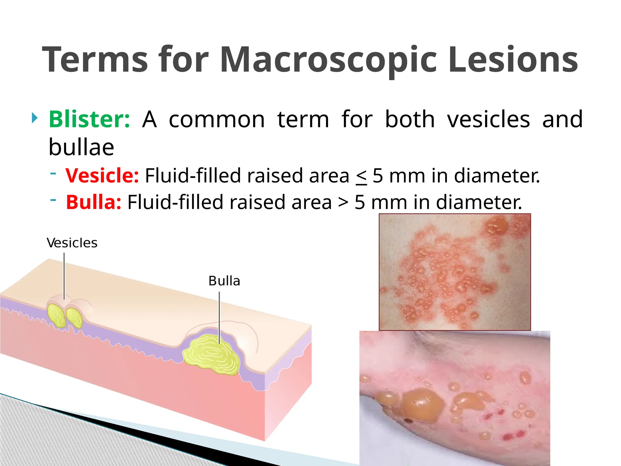 5-Skin histoPathology (non neoplastic).pptx